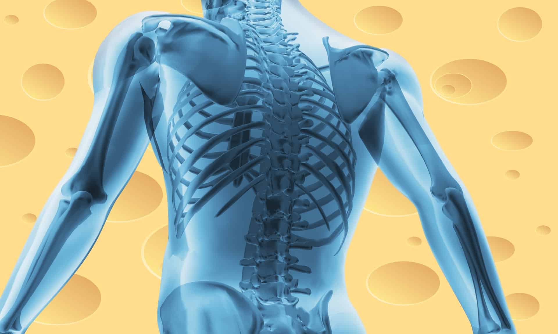 Strong Bones Osteoporosis And Ways To Keep Your Bones Healthy Self Strong Bones Osteoporosis And Ways To Keep Your Bones Healthy Self